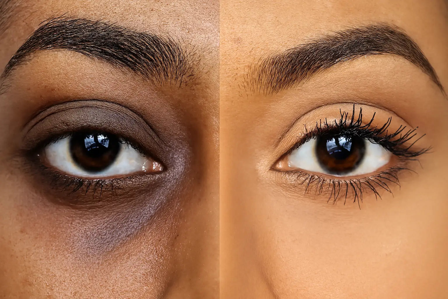 Say Goodbye to Dark Circles – Shop Effective Treatments Now – Derma.pk