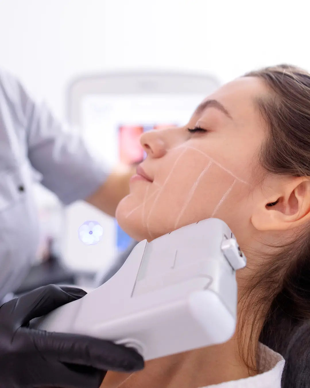 HIFU | Rediscover Youth, Lift Saggy Skin with Ultrasound – Tagged ...