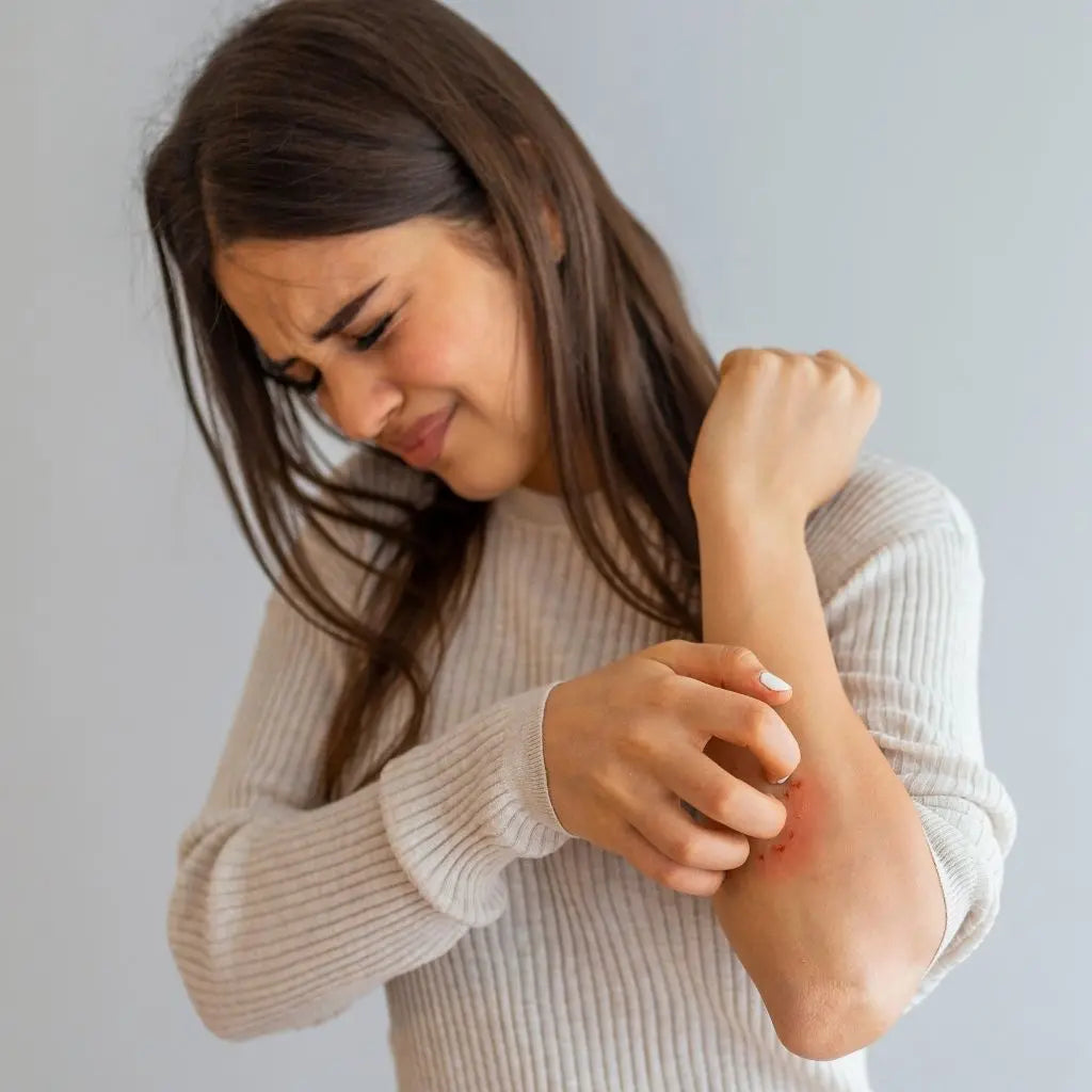 Psoriasis Treatment Products in Pakistan – Creams & Ointment – Tagged ...